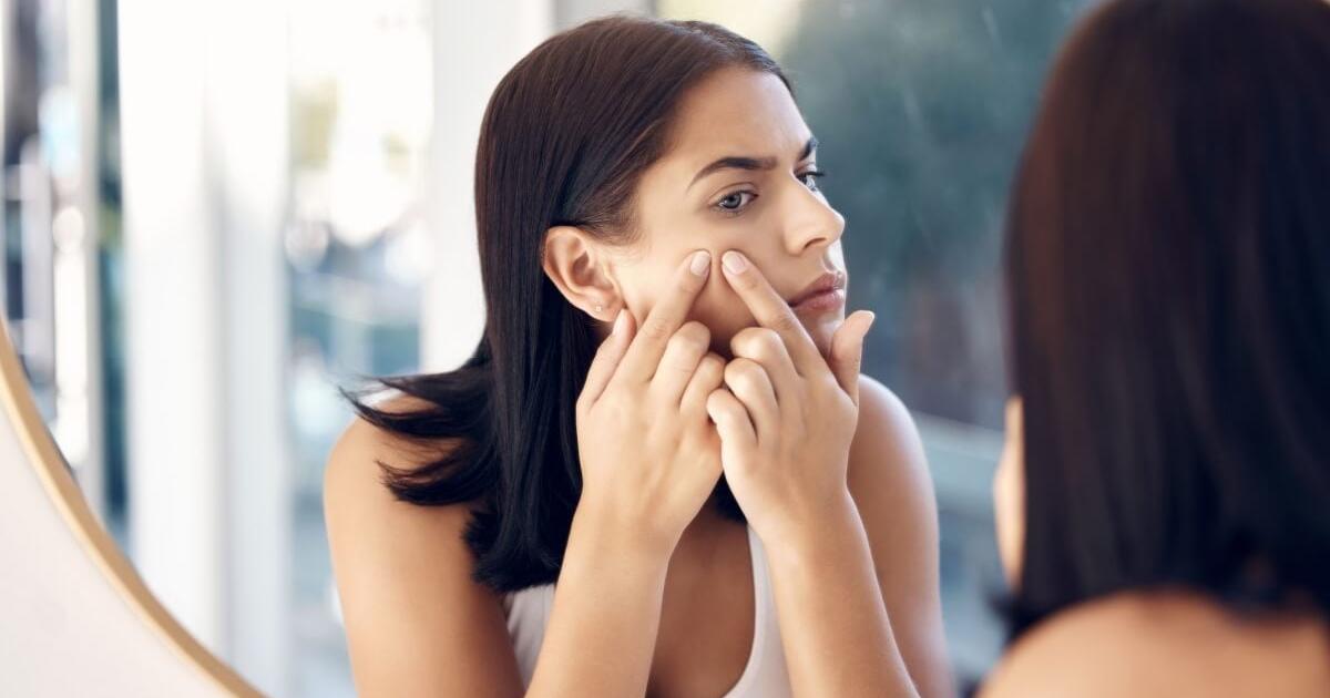 Portal T5 | 7 dicas para controlar a acne na vida adulta